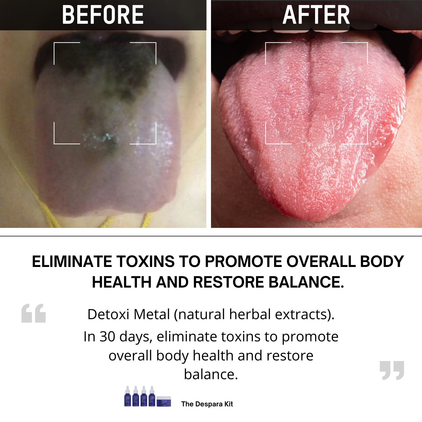 Detoxi Metal – Heavy Metal Detox Cleanse for Full-Body Detox | Dēspara ...