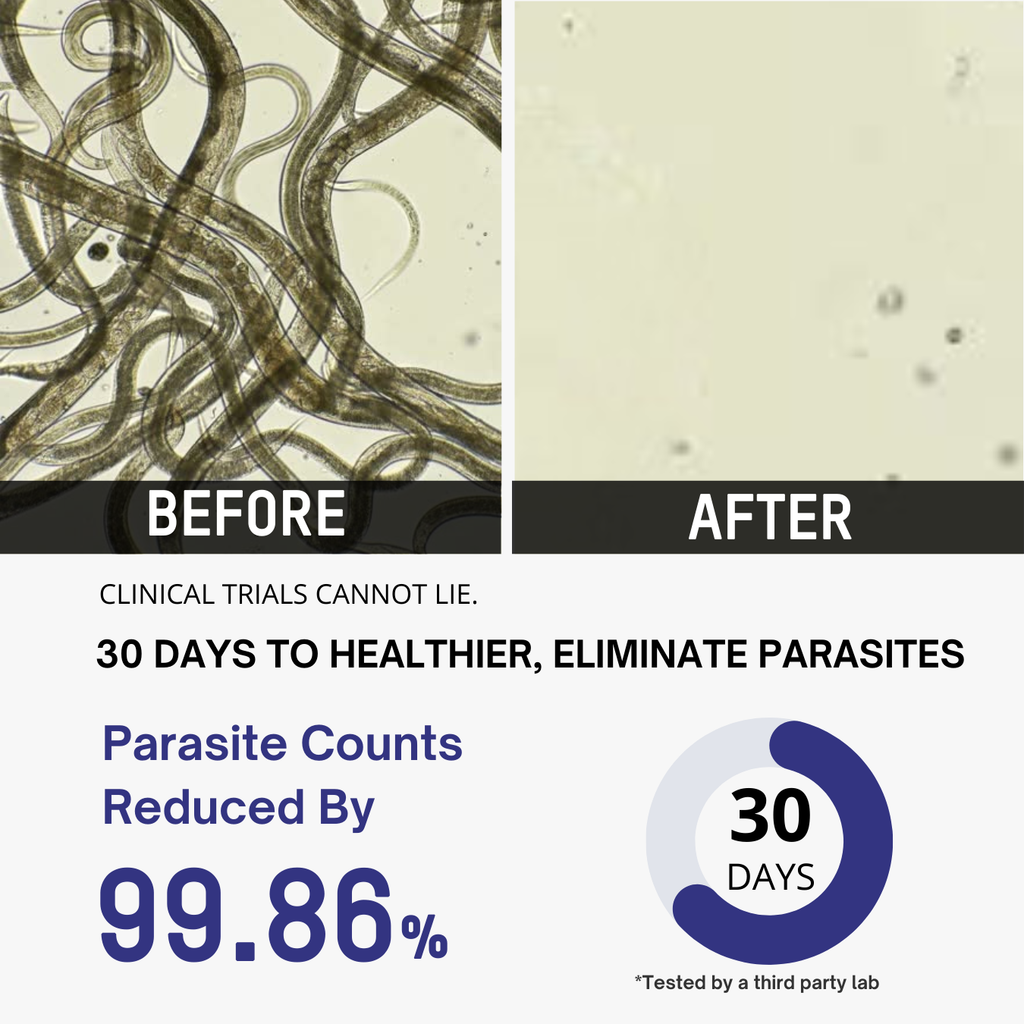 Dēspara Cleanse – Advanced Detox & Parasite Cleanse Formula – Despara life